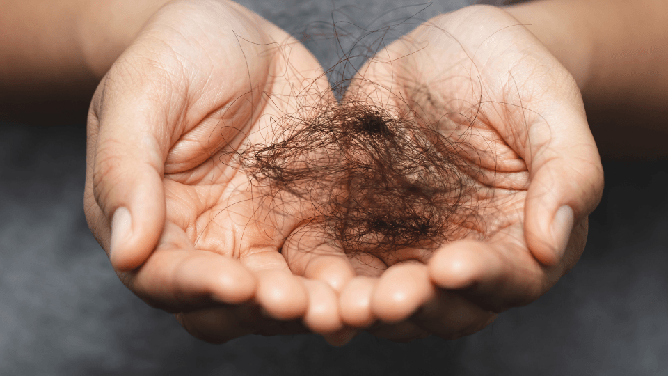 Obat Penumbuh Rambut Herbal atau Resep Dokter: Mana yang Lebih Disarankan?