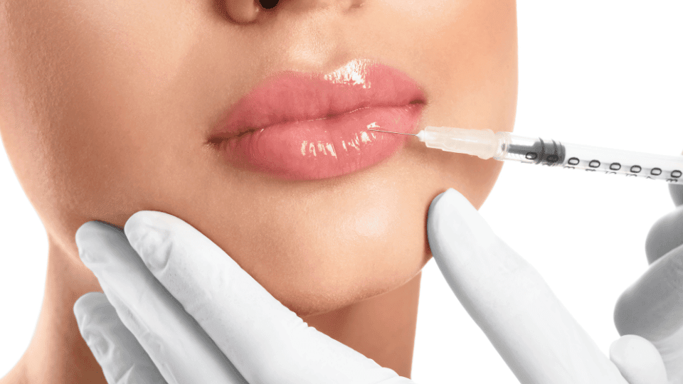 Apa Itu Filler? Ini Kandungan, Manfaat & Jenisnya