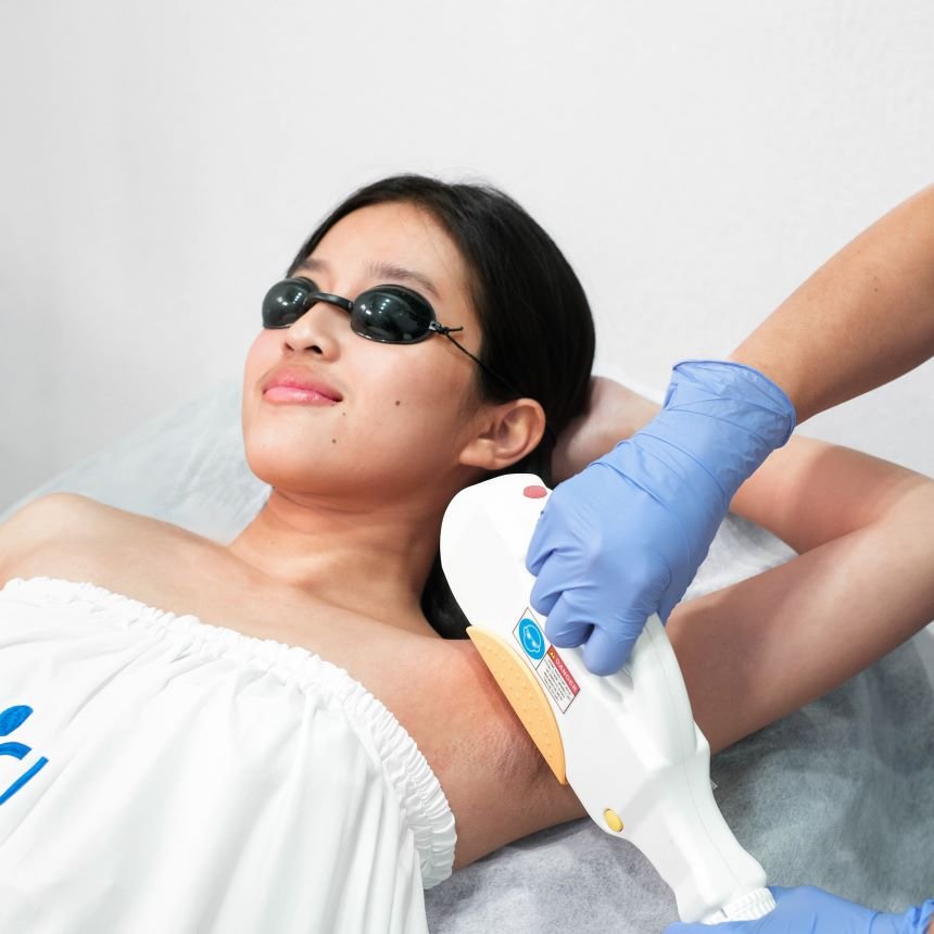 IPL Ketiak: Solusi Praktis untuk Ketiak Mulus & Bebas Bulu Permanen