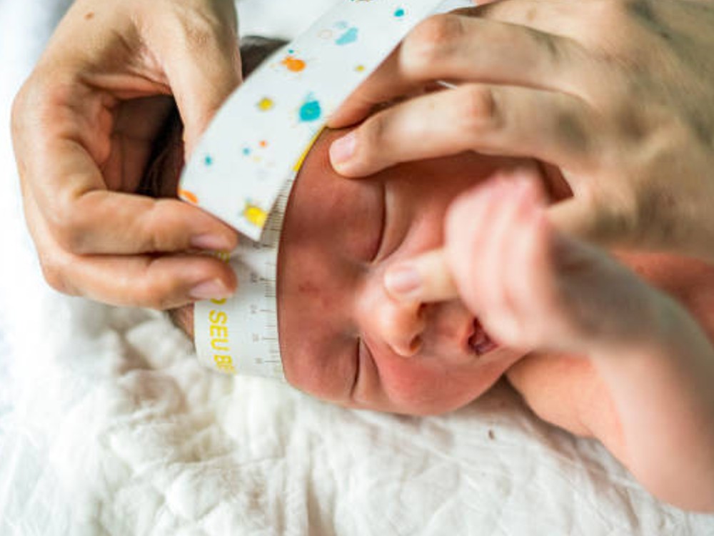 Ketahui Perkembangan Lingkar Kepala Normal pada Bayi | Articles ...